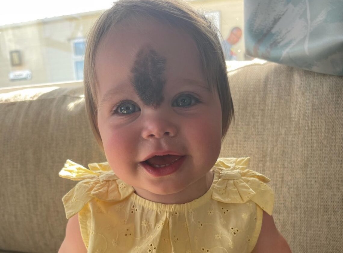 Ouders beschermen en verbergen dochter met moedervlek 2 jaar lang: “Nu ...